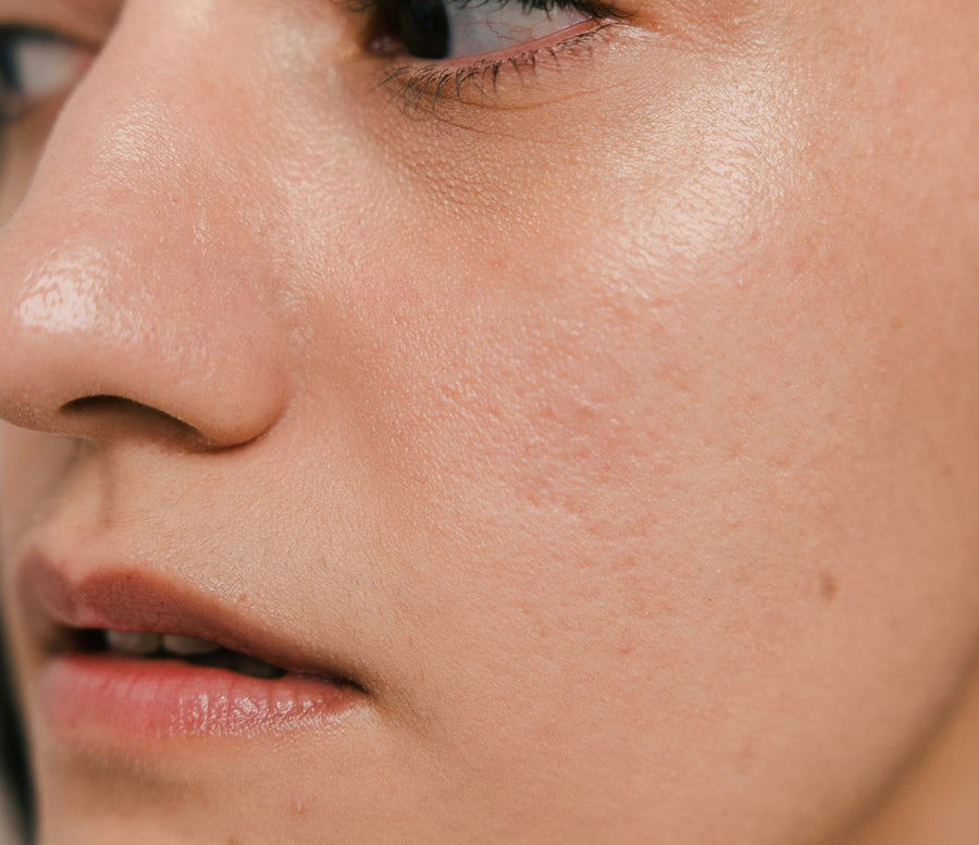 Damaged Skin Barrier? How to Strengthen, Protect, and Renew Your Skin ...