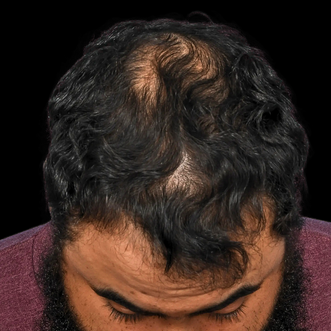 Shop HAIR Serum Today | Exosome Hair Care Products – ( plated )™ Skin ...