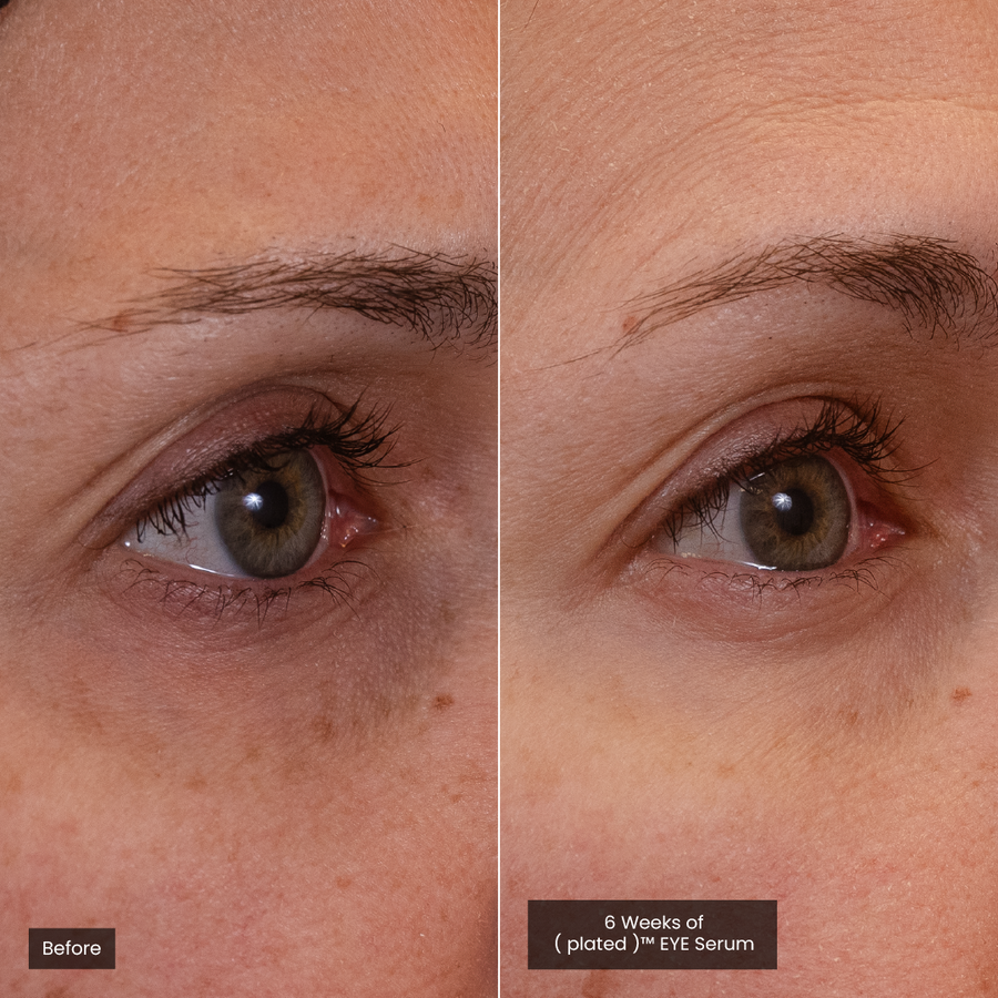 $138 (plated)™ Eye Exosome Serum | (plated)™ Official Site – ( plated ...