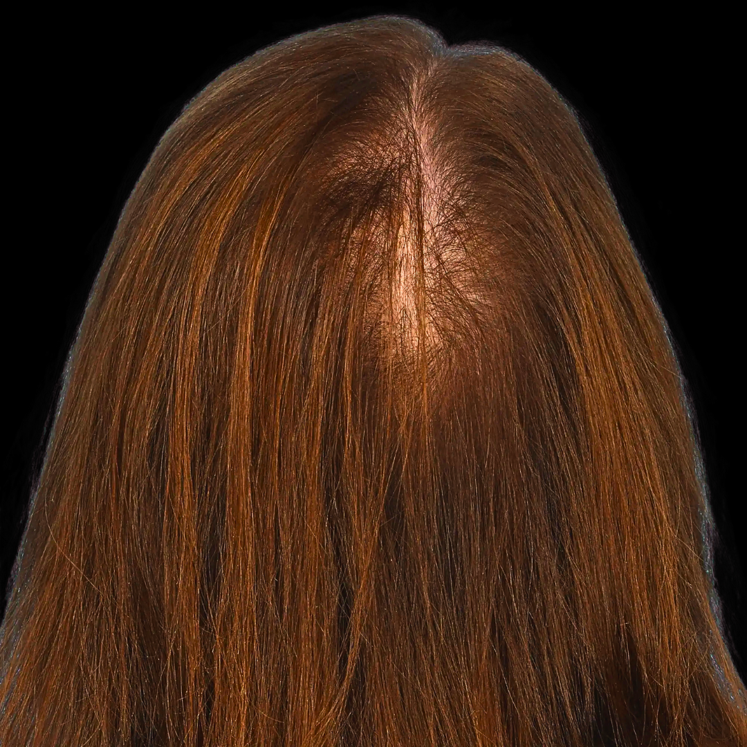 Shop HAIR Serum Today | Exosome Hair Care Products – ( plated )™ Skin ...