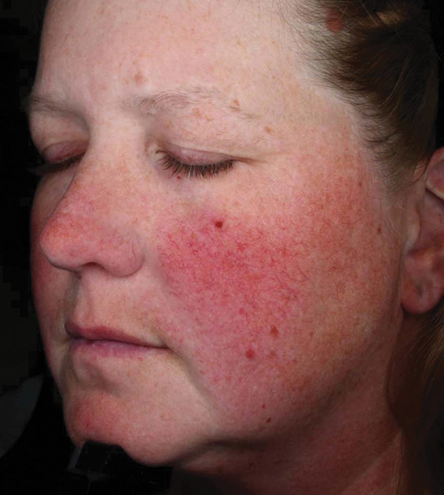 (plated)™ Skin Science: Renewosome™ Exosome Serums – ( plated )™ Skin ...