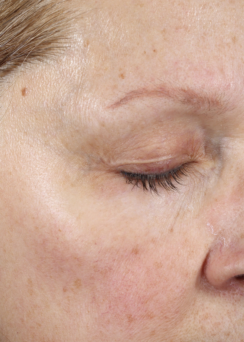 Buy INTENSE Serum Refill Today | Exosome Skin Care Products – ( plated ...