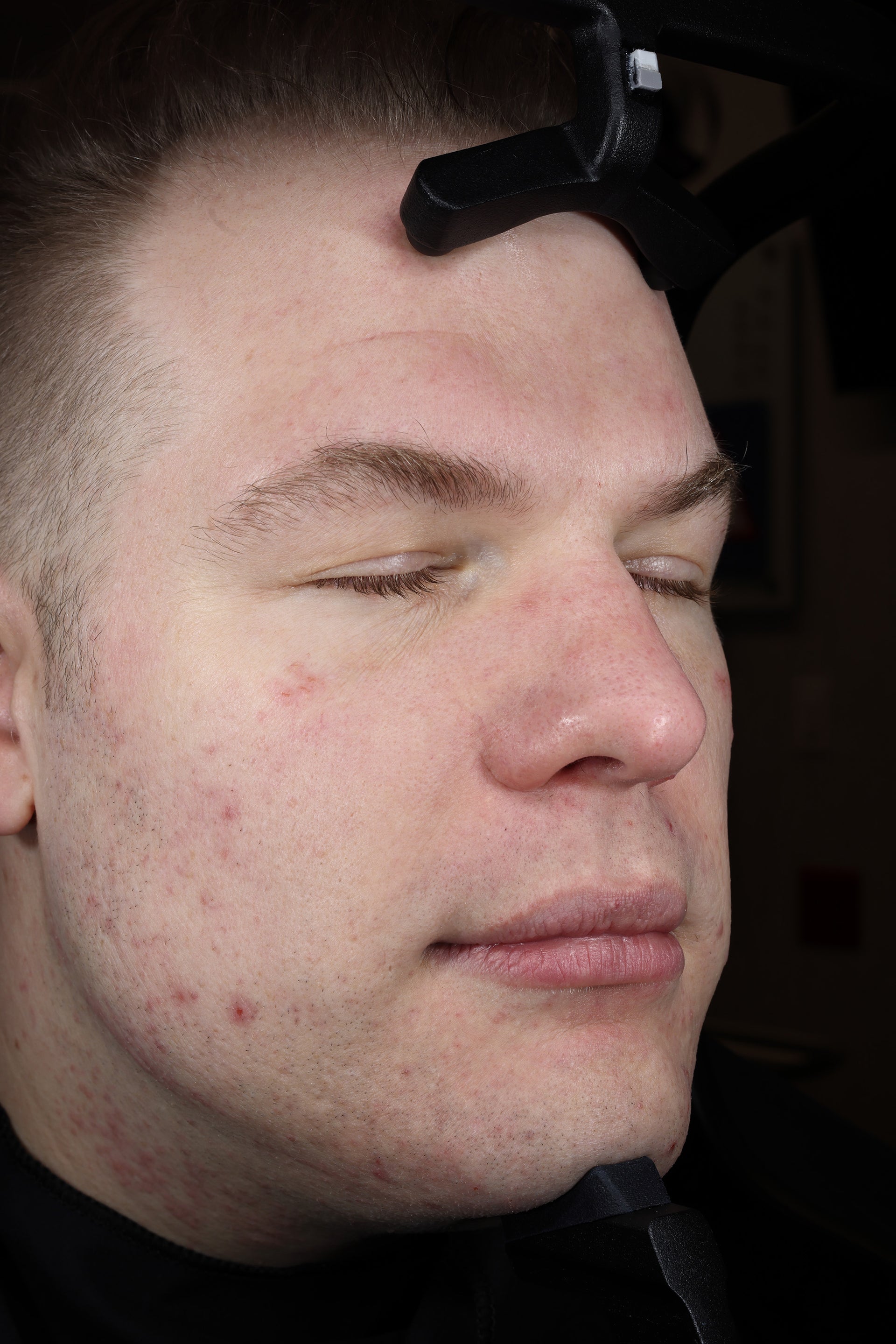 Buy DAILY Serum Today | Exosome Skin Care Products – ( plated )™ Skin ...