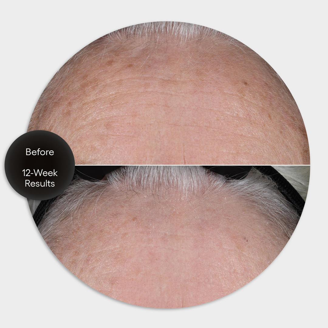 (plated)™ Skin Science: Renewosome™ Exosome Serums – ( plated )™ Skin ...